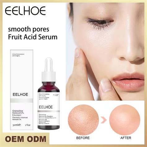 Eelhoe Granactive Retinoid Emulsion Lazada Ph