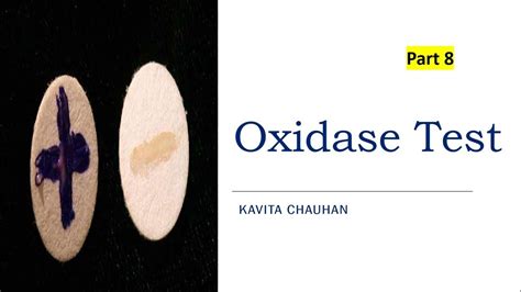 Oxidase Test Introduction Principle Procedure Result Interpretation In Hindi Youtube