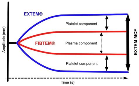 Basic Principles Of Rotational Thromboelastometry Rotem® And The Role Of Rotem—guided