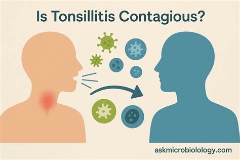 Is Tonsillitis Contagious Bacterial Vs Viral How Long And Prevention