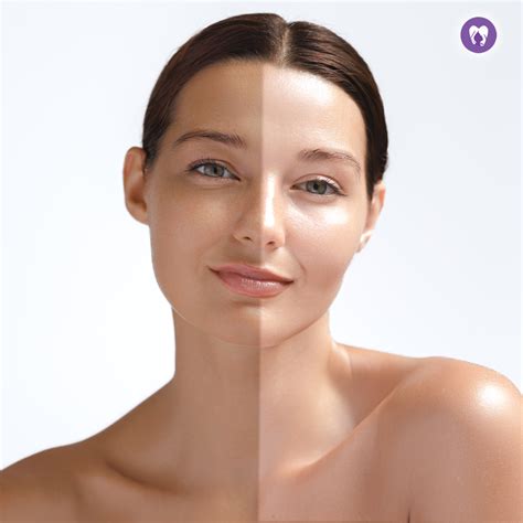 Unlock Your Radiant Beauty Skin Lightening And Brightening At Rootcosmo