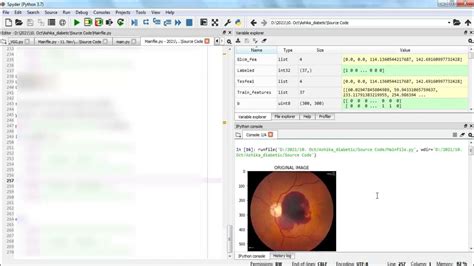 Hybrid Retinal Image Enhancement Algorithm Fordiabetic Retinopathy Diagnostic Using Deep