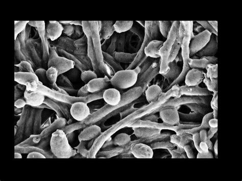 Gezond Darm Microbioom Belangrijk Voor Groei Skeletspieren New Scientist