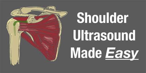 Ultrasound Guided Right Glenohumeral Joint Injection Pocus 101