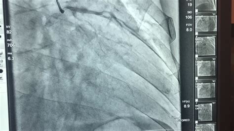 Cto Biradial Snuffbox Mihajlo Kovacic