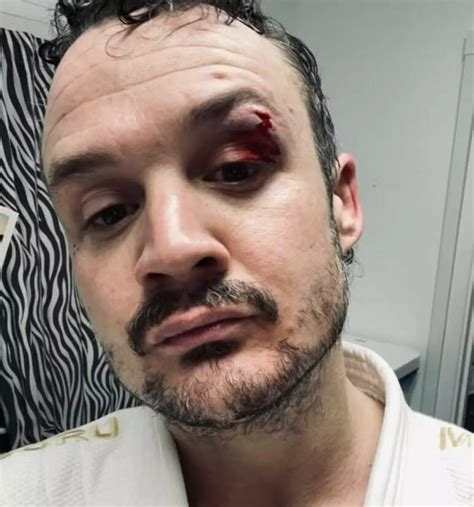 Harry Potter Stjernen Josh Herdman Fra Skuespiller Til Mma Kjemper