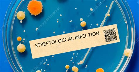 Streptococcal Infection Stock Image F042 0335 Science Photo Library