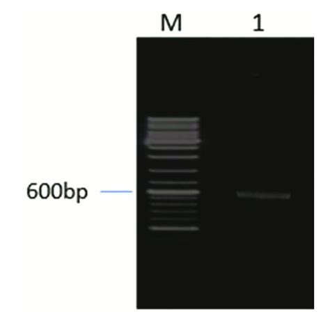 Agarose Gel Of ~1500 Bp Of Pcr Product Using 16s Rdna Primer 8f And Download Scientific Diagram