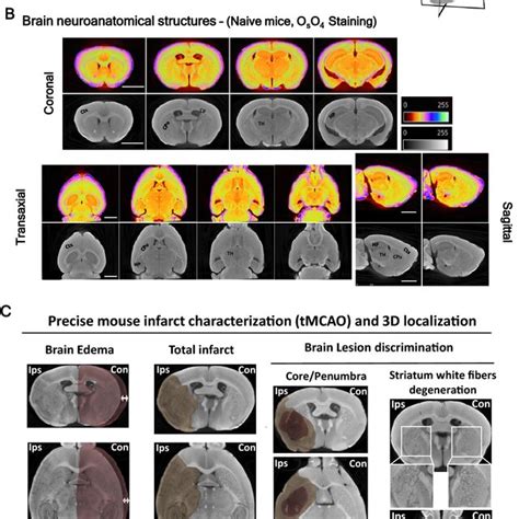 Identification Of Brain Neuroanatomical Areas In Download Scientific Diagram