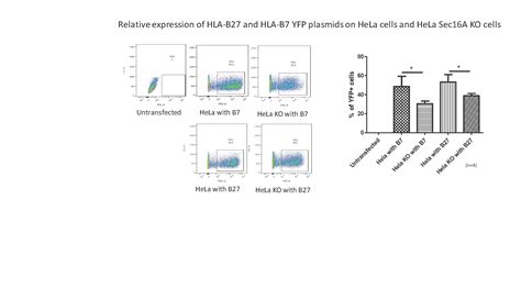 Sec16a Abnormalities Affect The Intracellular Trafficking Of Hla B27 In The Pathogenesis Of