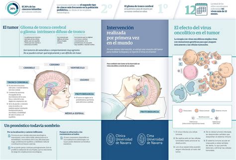 Una puerta abierta en el tratamiento de los tumores cerebrales en niños ...