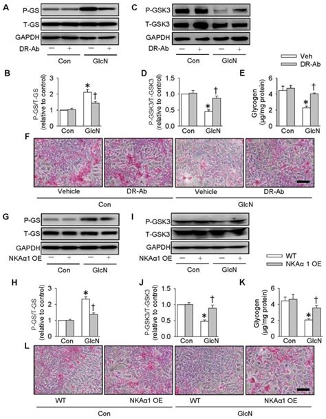 DR Region Of Na K ATPase Is A Target To Ameliorate Hepatic Insulin Resistance In Obese