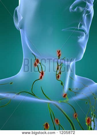 Swollen Lymphatic Image And Photo Free Trial Bigstock