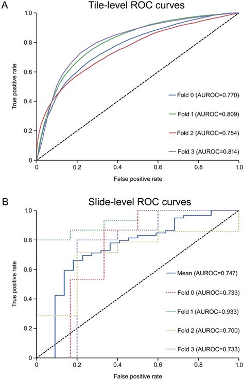 Receiver Operating Characteristic Roc Curves And Area Under