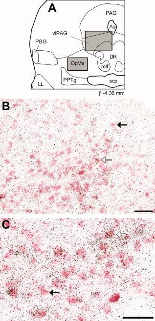 distribution of 5 ht1ar and 5 htt mrnas in the median raphe nucleus