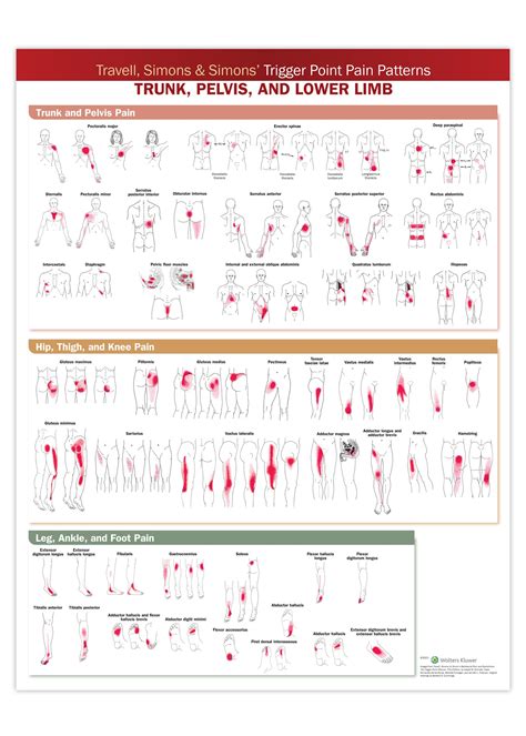 Trigger Points Eanatomi