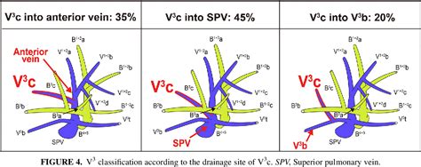 Figure 4 From Segmentectomy Oriented Anatomical Model For Enhanced Precision Surgery Of The Left