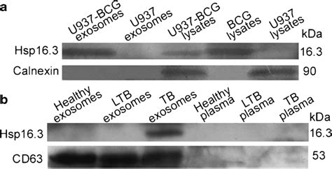 Detection Of Hsp16 3 Protein Expression By Using Western Blots A