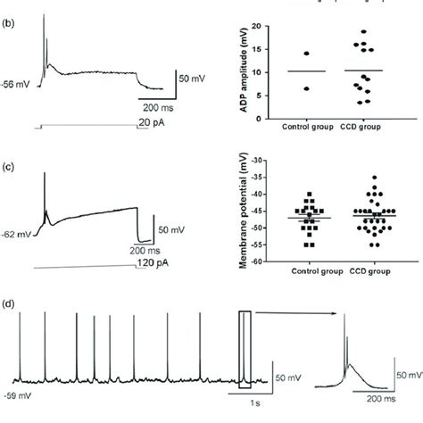 Low Threshold Adp Firing Of Drg Neurons A Representation Of