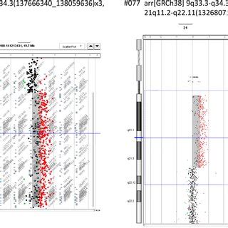 Array‐CGH analysis of DNA from patient MP03. Profile of chromosome 21... | Download Scientific ...