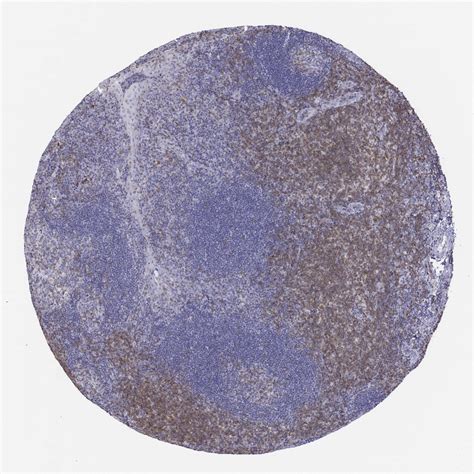 Tissue Expression Of Cd3e Staining In Tonsil The Human Protein Atlas