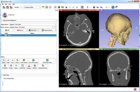 interpolation between slices support 3d slicer community