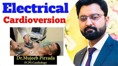 Electrical Cardioversion Cardioversion Defibrillation Youtube