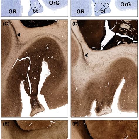 Acetylcholinesterase Distribution In The Primary Olfactory Gyrus A