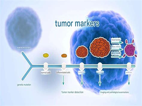 Immunohistochemical Ihc Tumor Markers Common Breast Cancer Diagnos