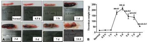 Inferior Vena Cava Ivc Stenosis Model Creative Bioarray Creative