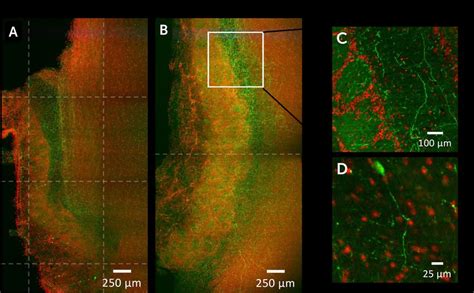 Super Resolution Light Sheet Expansion Microscopy