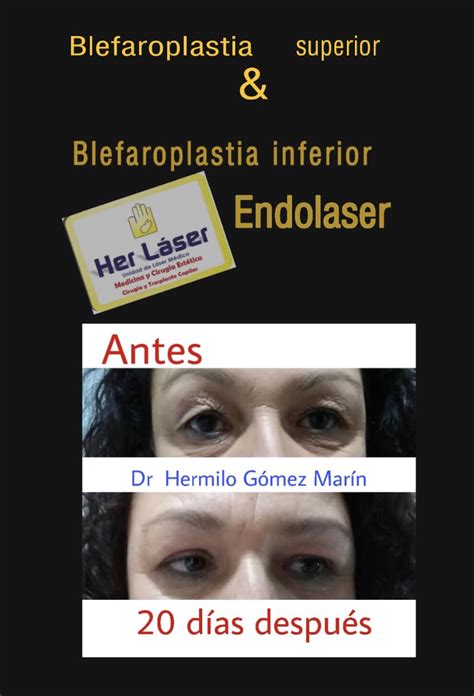 Her Laser Tratamientos Estéticos En Huelva