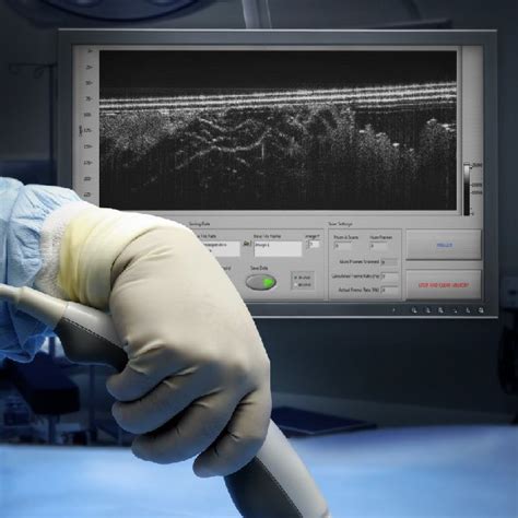 Simulated Representative Intraoperative Imaging Scenario Using An Download Scientific Diagram