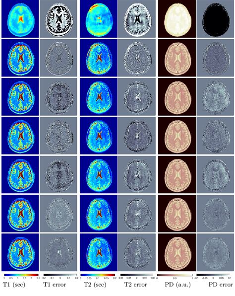 Compressive Mr Fingerprinting Reconstruction With Neural Proximal Gradient Iterations Paper And