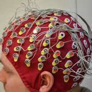 An AEEG Tracing Black With Upper And Lower Margins Red A Download Scientific Diagram