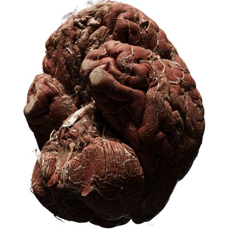 Application Of 3d Gaussian Splatting For Cinematic Anatomy On Consumer