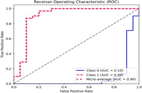 Enhancing Brain Tumor Diagnosis An Optimized Cnn Hyperparameter Model