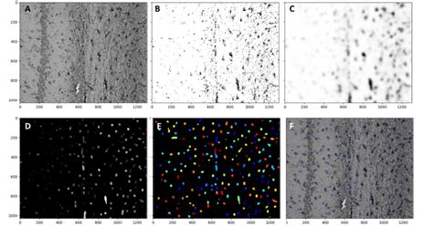 A Pipeline For The Astrocyte Quantification Raw Image From The Download Scientific Diagram