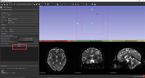 使用3d slicer进行图像配准 csdn博客