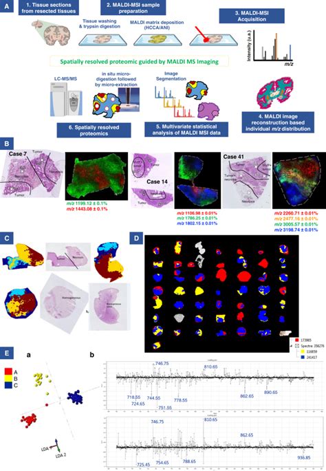 胶质母细胞瘤蛋白质组的空间分析揭示了特定的分子特征和生存标记 Nature Communications X Mol