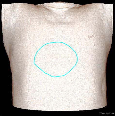 医学图像处理软件实战开发qt C Vtk 5医疗器械 Qt 图形图像 Csdn博客