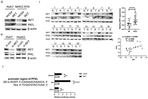 Exosomal Mirna 146a 5p Derived From Senescent Hepatocellular Carcinoma