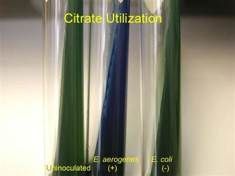 Imvic Tests Citrate Utilization Test Microbiology Lab Exam 2 Shasta College Meacham