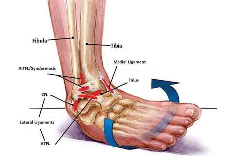 Lateral Ankle Instability Foot And Ankle Specialists In Kelso Tweed