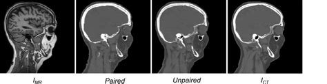 From Left To Right Input Mr Image Synthesized Ct Image With Paired Download Scientific Diagram