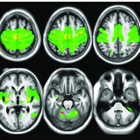 calculation of functional connectivity between averaged sensorimotor