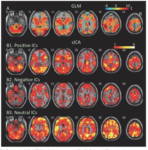 Figure 1 From Functional Network Overlap As Revealed By Fmri Using Sica