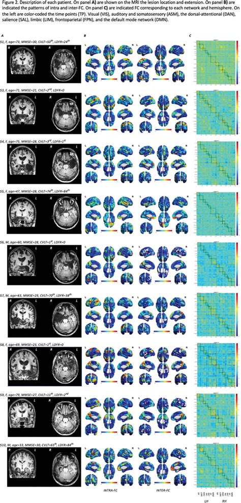 Functional Brain Networks Reorganization In The Absence Of Medial Temporal Lobe Structures An