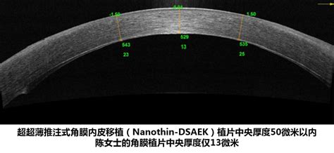 温州医科大学眼视光医院集团