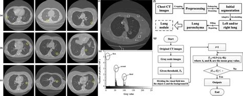 lung parenchyma segmentation typical categories for pulmonary nodules